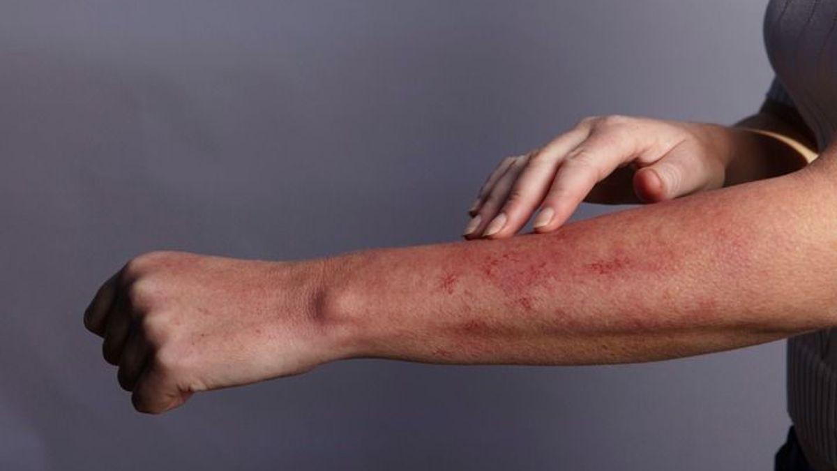 Premiers secours pour les brûlures : guide complet traitement et prévention